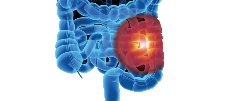 Fekal Kalprotektin Testi Fiyatları 2026 | İstanbul Laboratuvarları